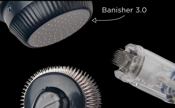 Banish - Top Rated At Home Microneedling for Acne Scars
