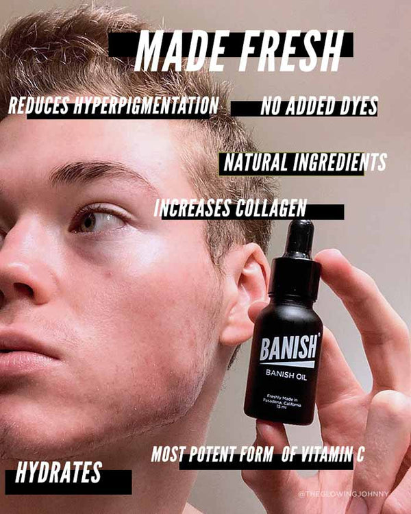 Banish Serum - Vitamin C, E, Ferulic Serum Dark Spot Corrector For Acne ...